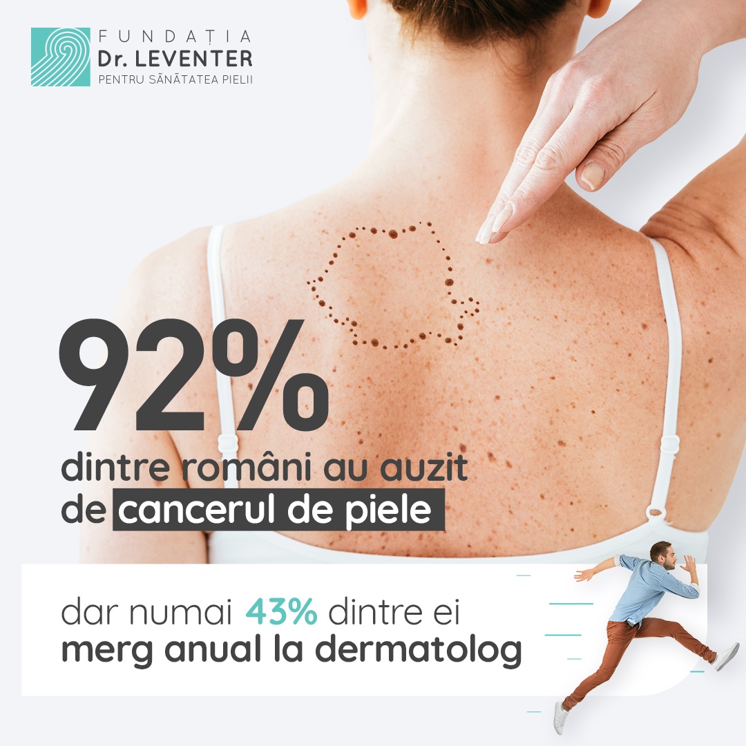 Românii sunt informați despre cancerul de piele, dar nu obișnuiesc să ...
